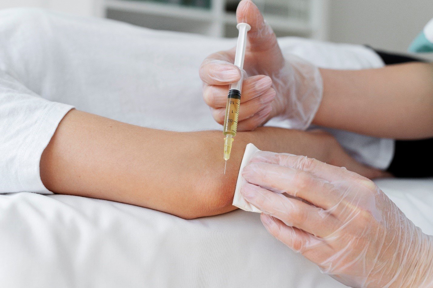 PRP - Lifestyle Physicians